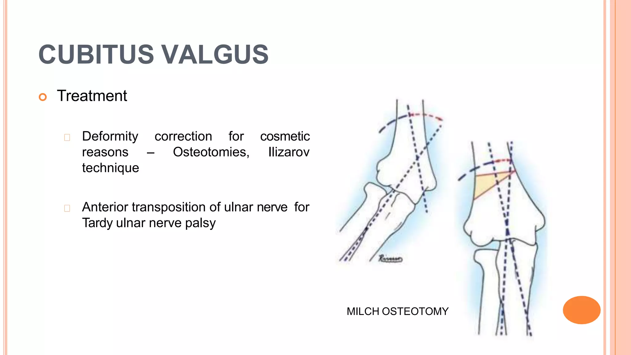 Cubitus varus and valgus | PPTX