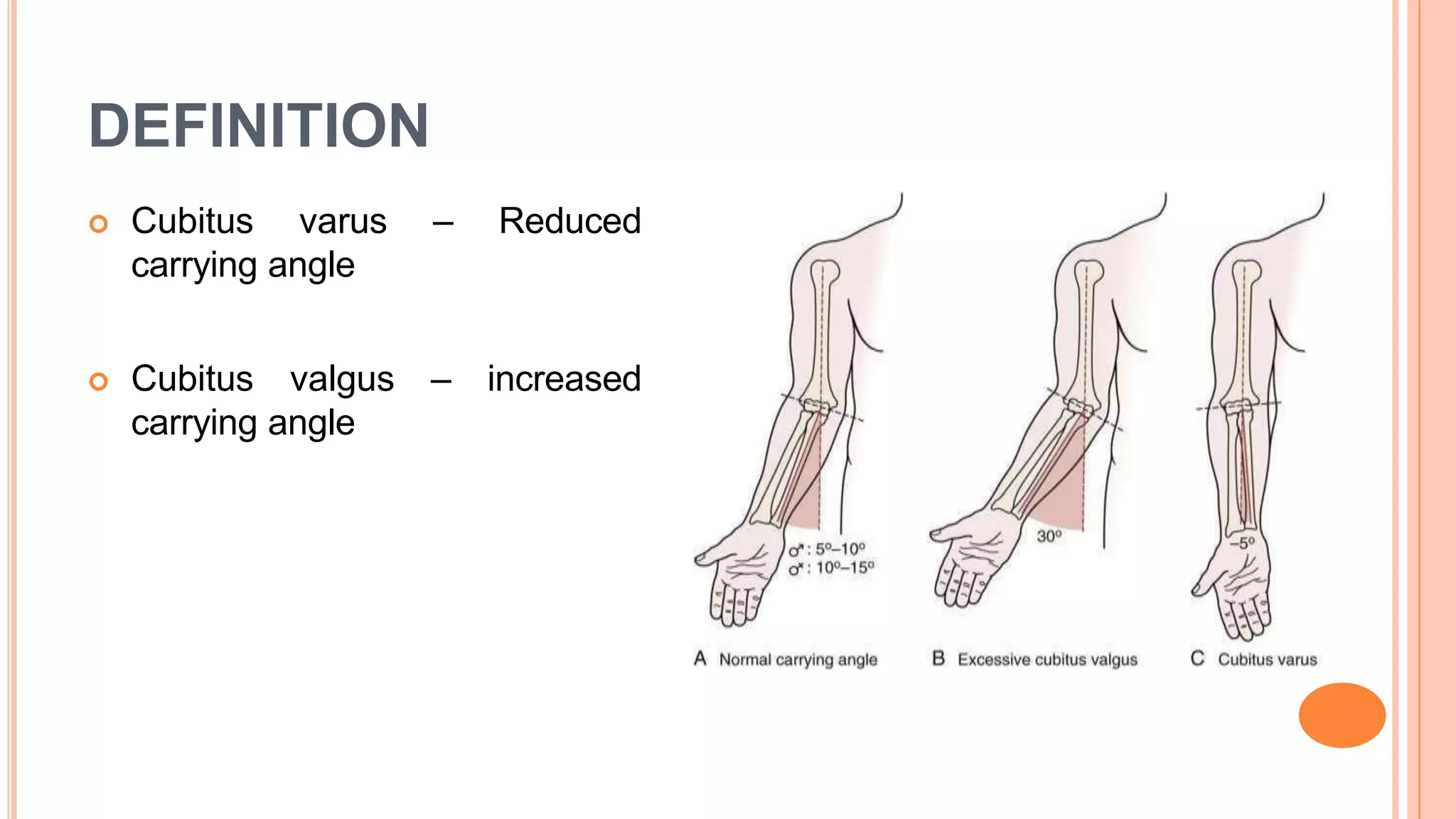Cubitus varus and valgus | PPTX