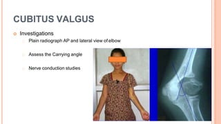 Cubitus varus and valgus | PPTX