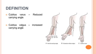 Cubitus varus and valgus | PPTX