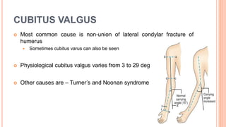 Cubitus varus and valgus | PPTX