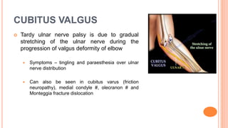 Cubitus Valgus And Cubitus Varus