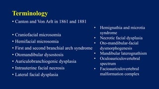 Craniofacial Microsomia and Hemifacial Atrophy | PPTX