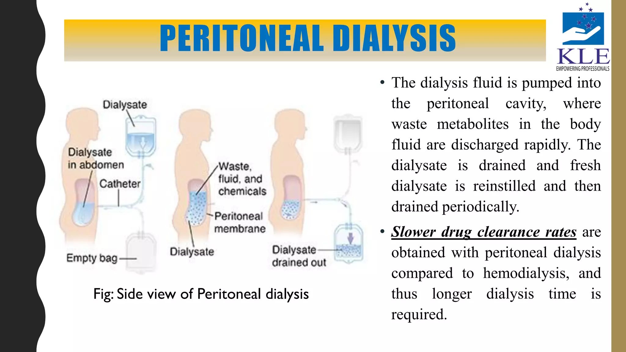 Extracorporeal removal of drugs | PDF
