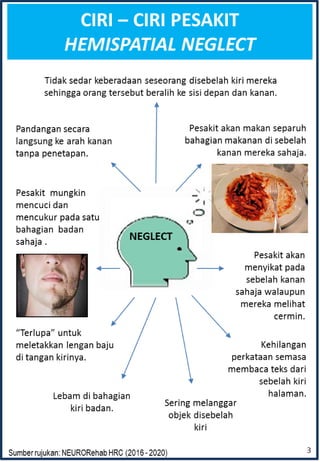 Hemispatial Neglect | PDF