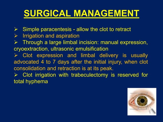 Hyphema | PPT