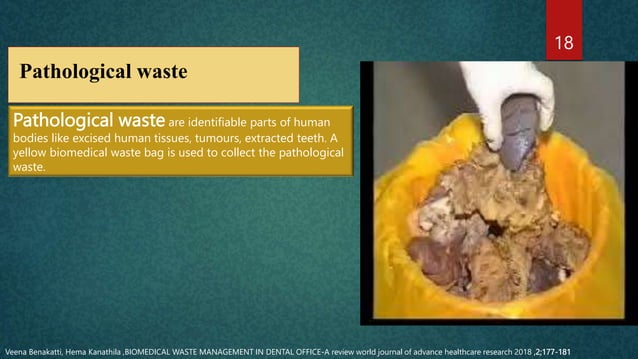 19.. HOSPITAL WASTE MANAGEMENT dentistry | PPTX | Infectious Diseases ...
