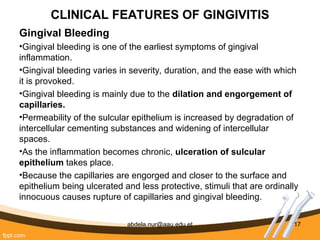 19. Stages of gingivitis. ppt explaining | PPT