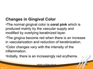 19. Stages of gingivitis. ppt explaining | PPT