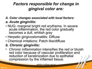 19. Stages of gingivitis. ppt explaining | PPT