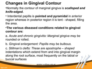 19. Stages of gingivitis. ppt explaining | PPT