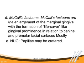 19. Stages of gingivitis. ppt explaining | PPT