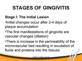 19. Stages of gingivitis. ppt explaining | PPT