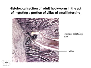 19. The Hookworms-DD-DG.pptx PARASITOLOGY | PPTX