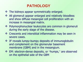 19 Acute Glomerulonephritis | PPT
