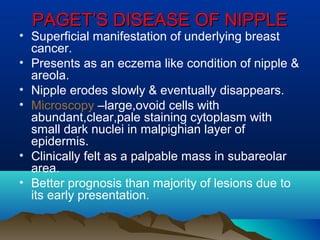 aetiology,pathology & clinical features of breast cancer | PPT