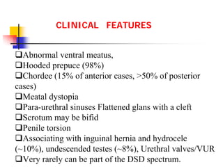 Hypospadias Ppt 8419