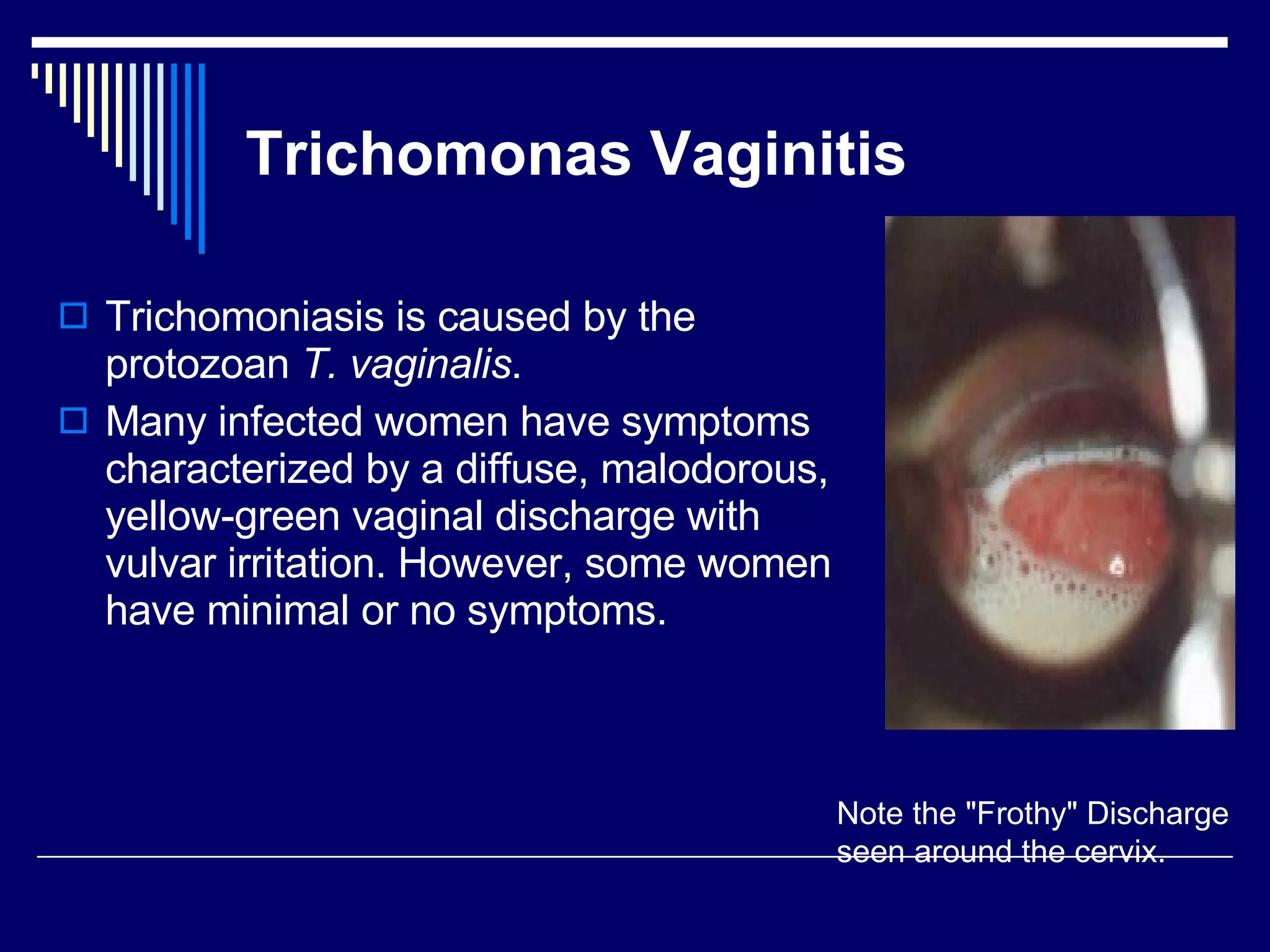 19.Infection Of Vaginal | PPT