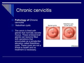 19.Infection Of Vaginal | PPT
