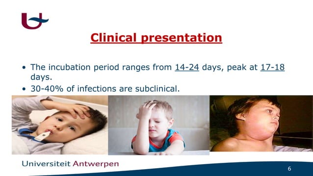 mumps Pathology | PPT