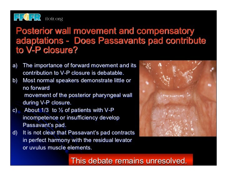 19.(new)speech and velopharyngeal function