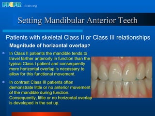 19. occlusal schemes lingualizied oposing monoplane with balancing ...