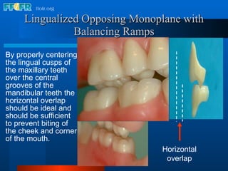 19. occlusal schemes lingualizied oposing monoplane with balancing ...