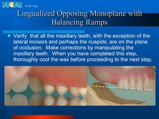 19. occlusal schemes lingualizied oposing monoplane with balancing ...