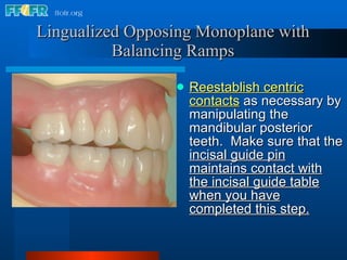 19. occlusal schemes lingualizied oposing monoplane with balancing ...