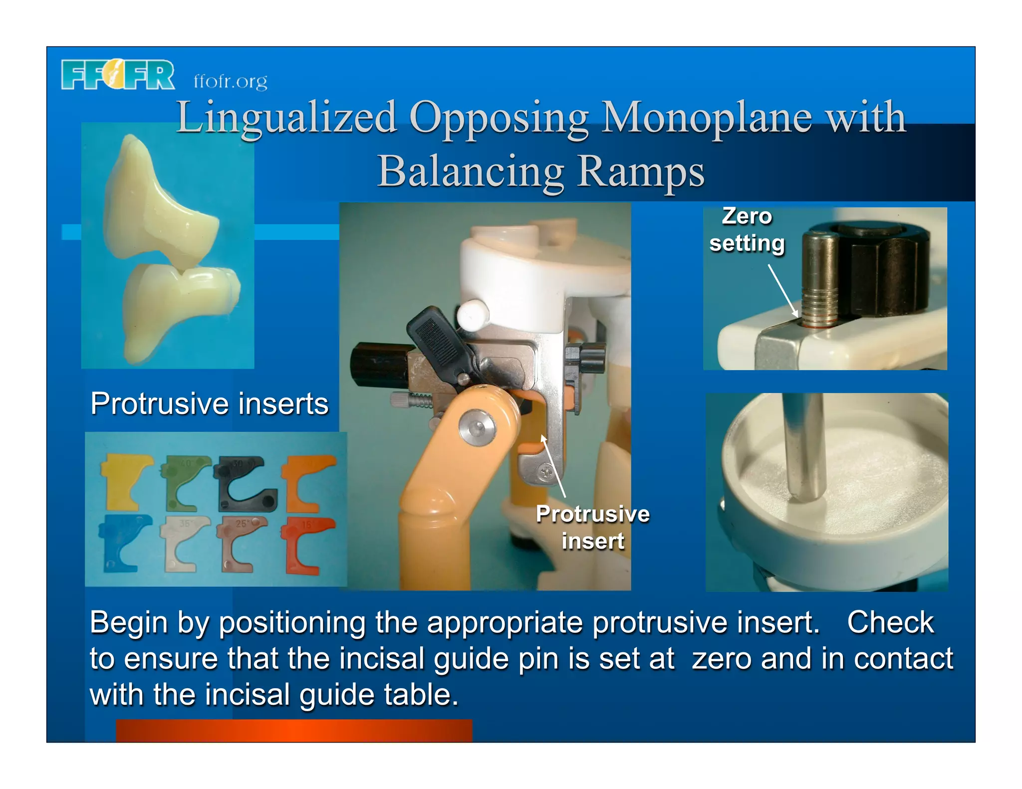 19. occlusal schemes lingualizied oposing monoplane with balancing ...