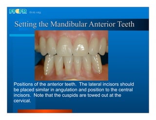 19. occlusal schemes lingualizied oposing monoplane with balancing ...