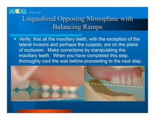 19. occlusal schemes lingualizied oposing monoplane with balancing ...