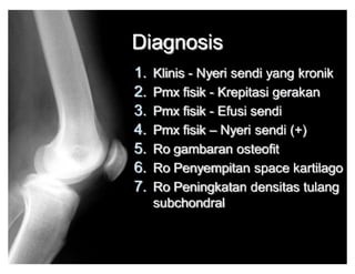 Osteoarthritis Refrat | PDF