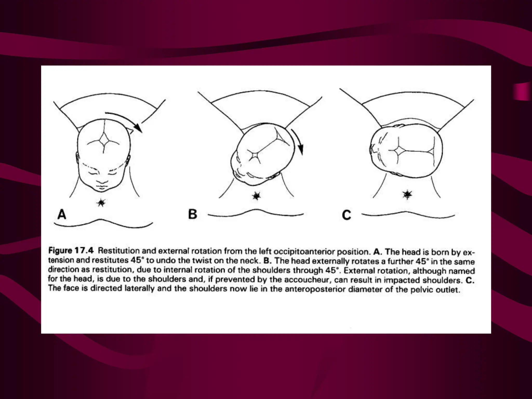 ppt on normal labour and its management | PPT | Pregnancy ...