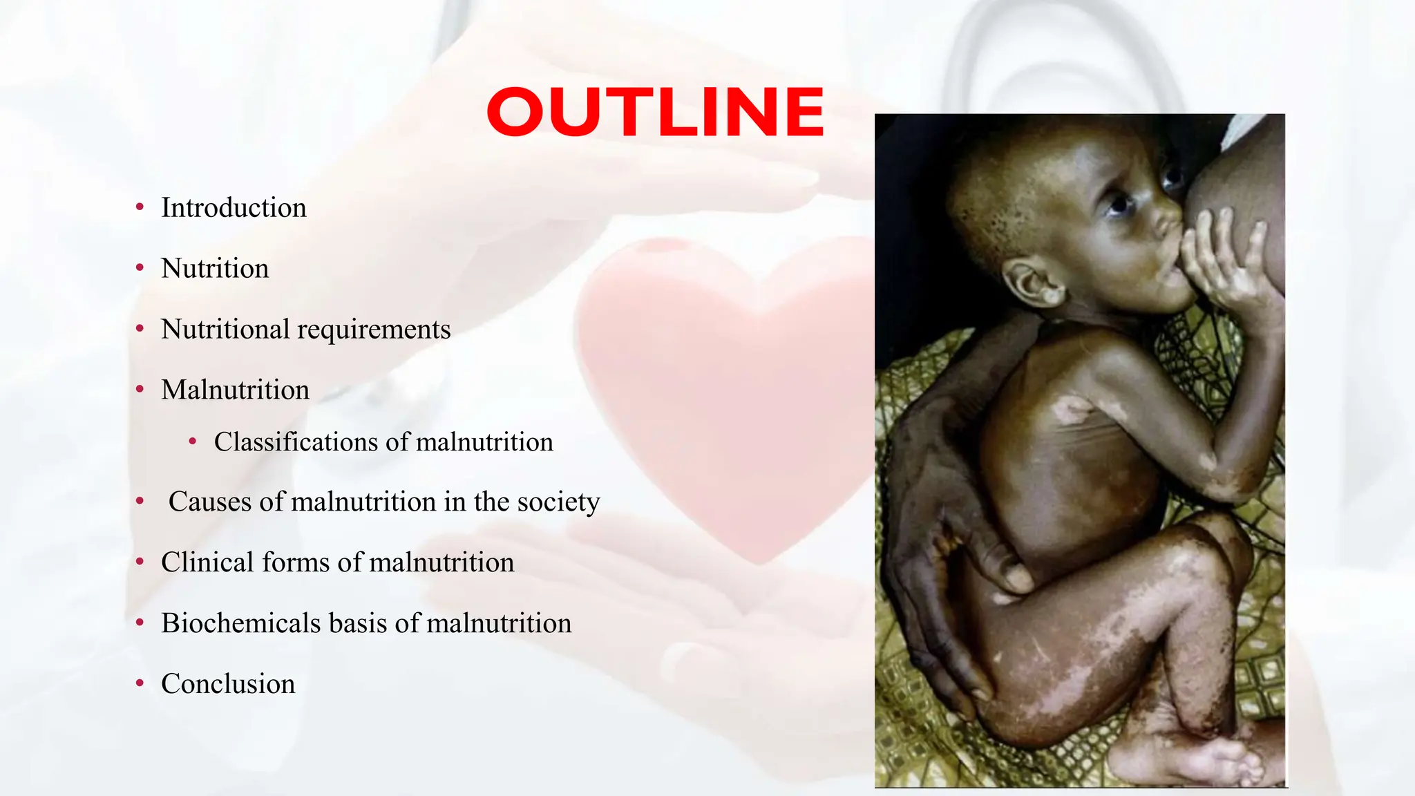 Basics of malnutrition 909001031 presentation.pptx