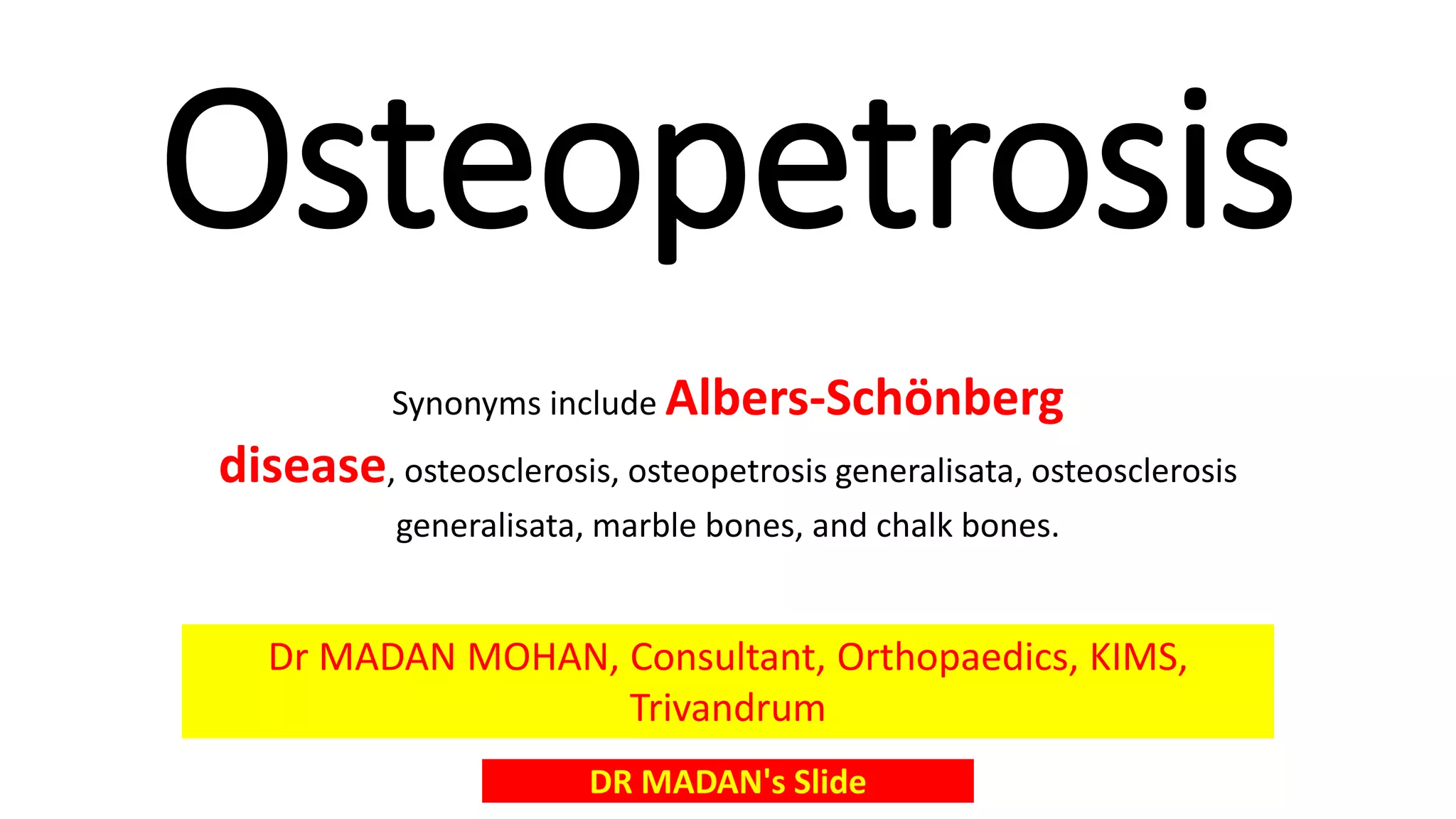 191019 osteopetrosis | PPTX
