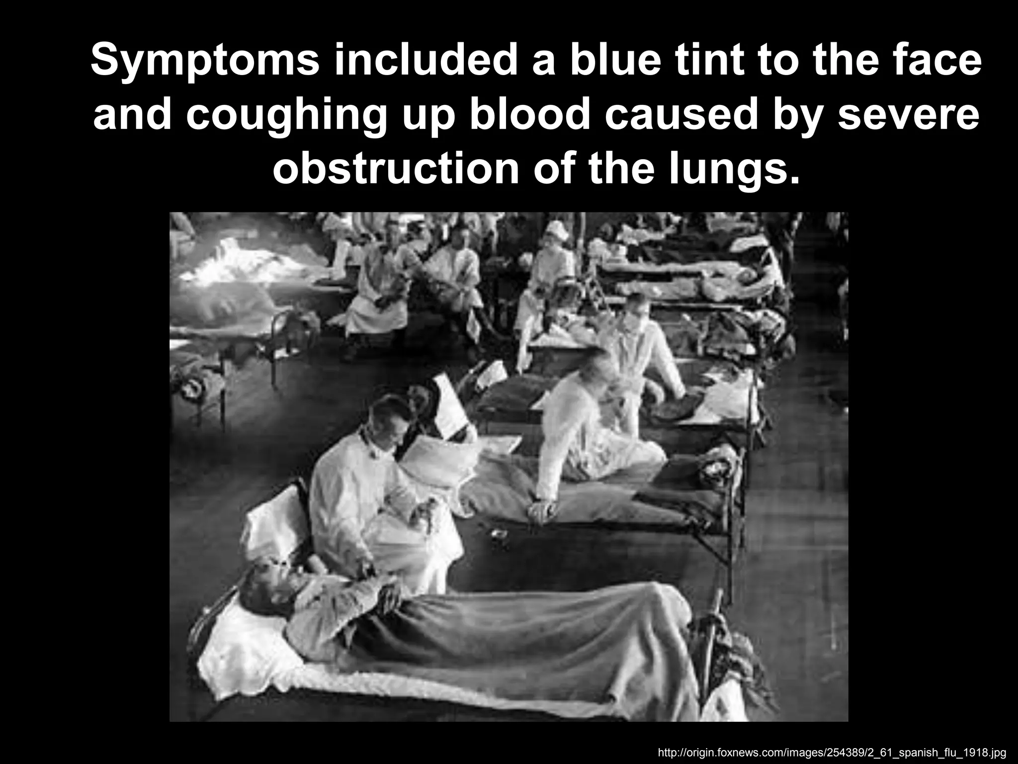 1918 Flu Epidemic | PPT