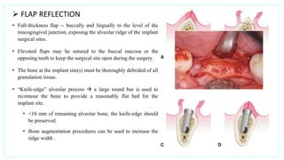 Dental Implants- part I and II: Biological and surgical aspects | PPTX