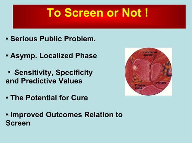 Prostate cancer (screening) | PPT
