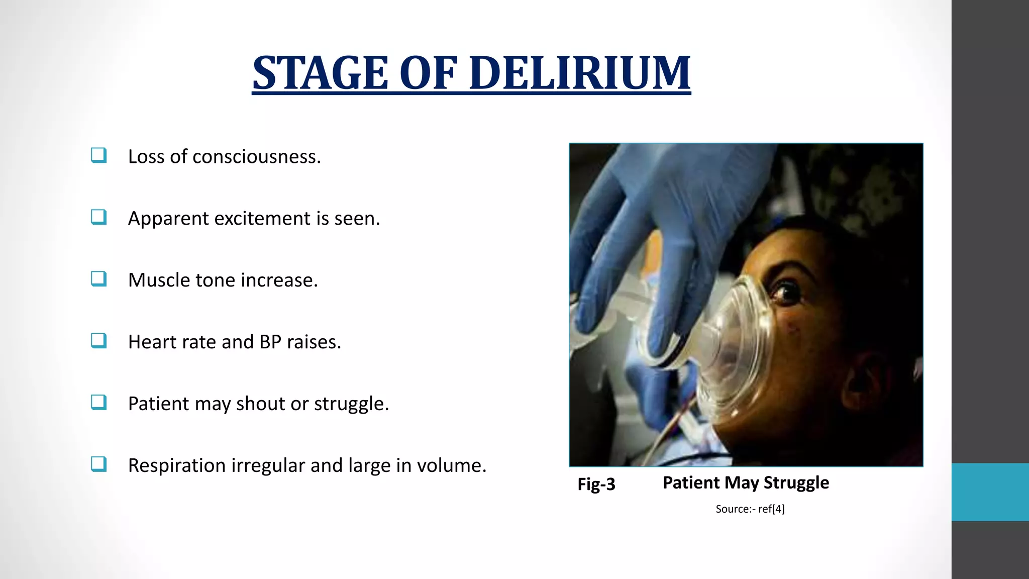 Stages of General Anaesthesia | PPTX