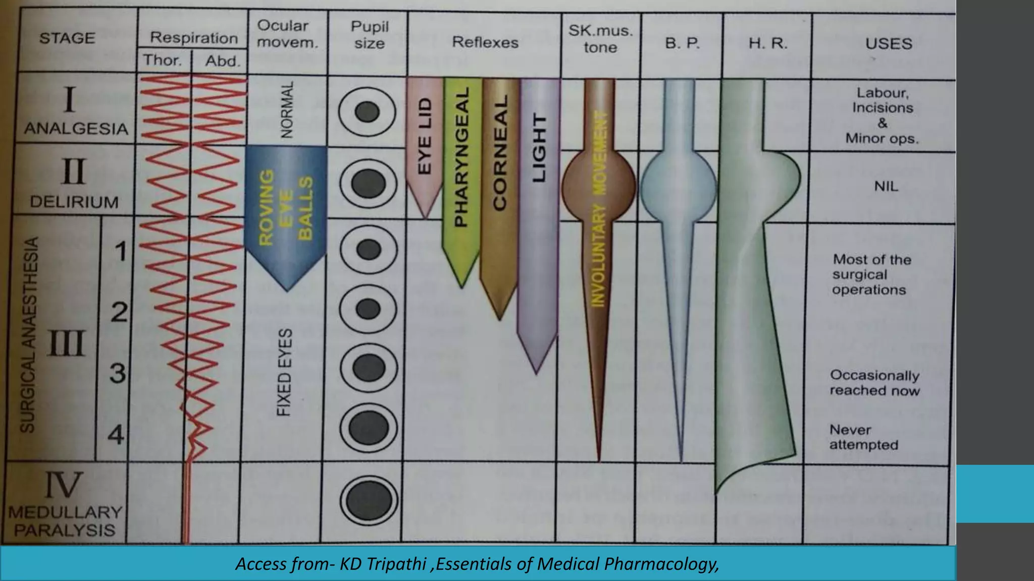 Stages of General Anaesthesia | PPTX