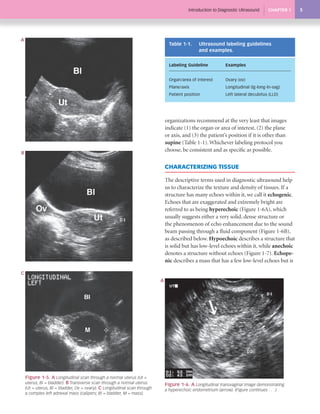193656406 ultrasound-in-obstretics | PDF