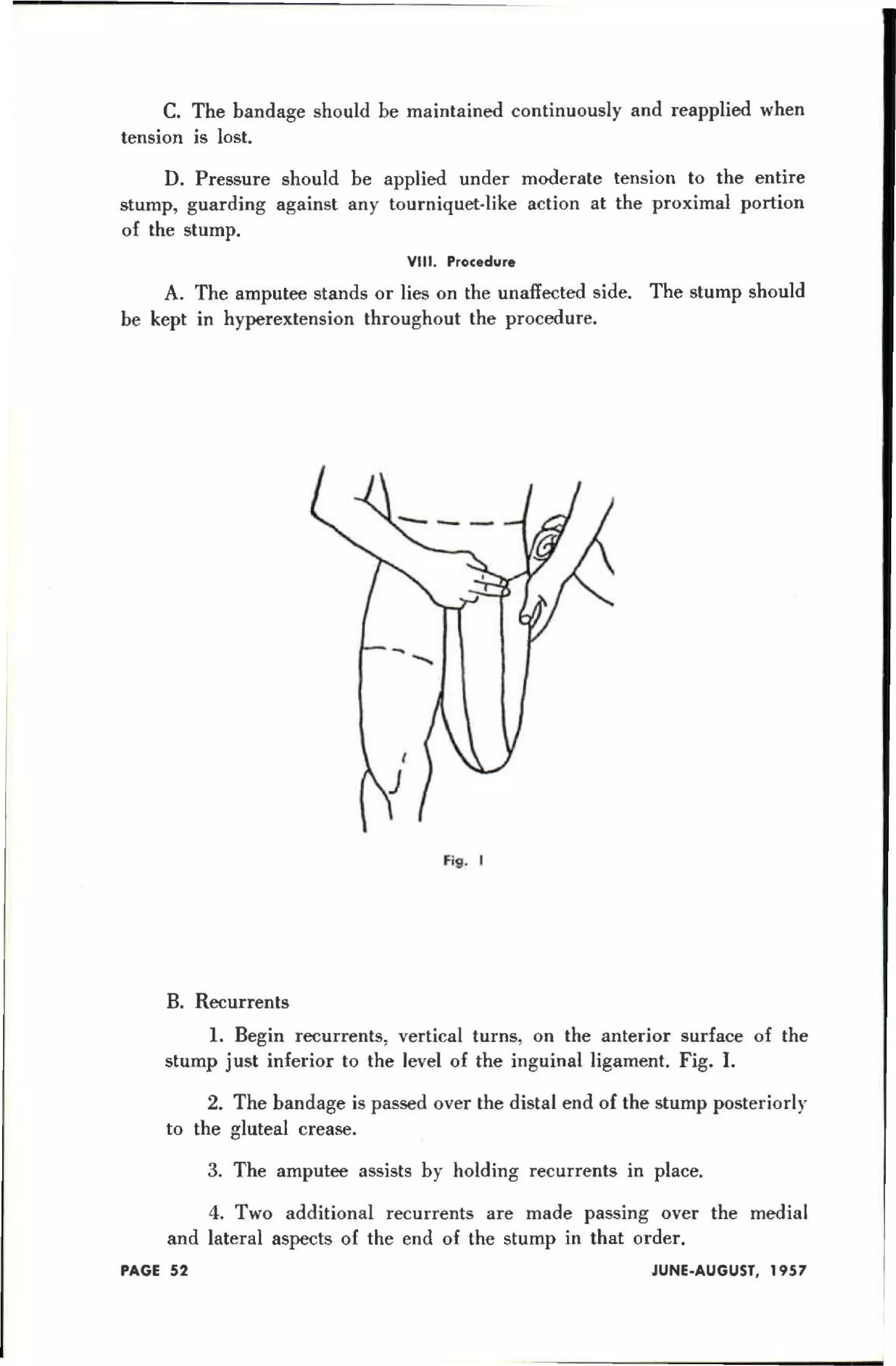 amputation bandage | PDF