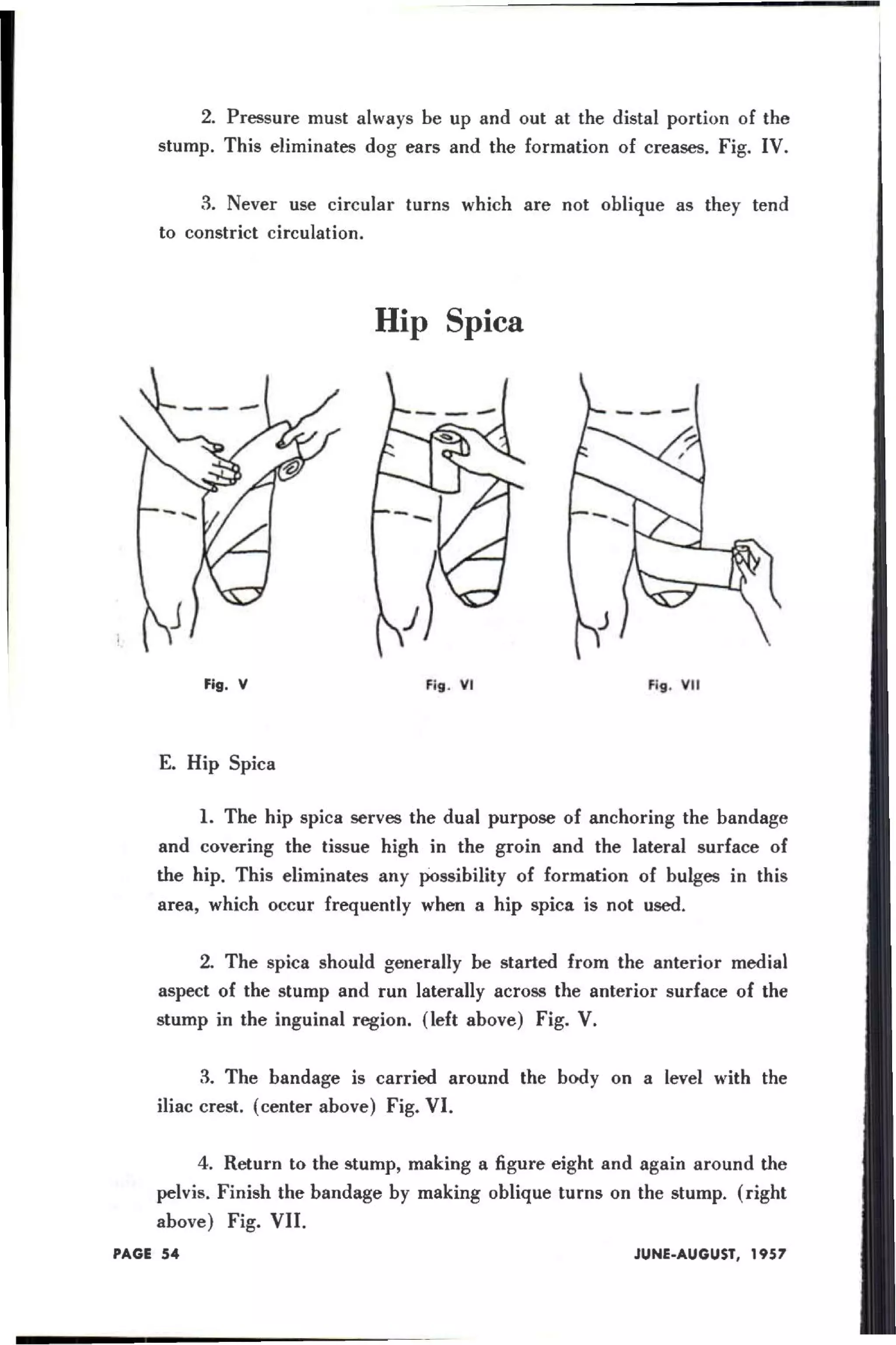 amputation bandage | PDF