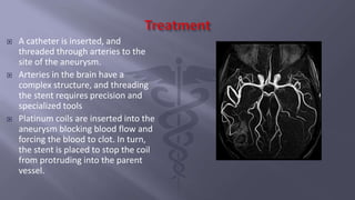Blood Flow Through Cerebral Aneurysms | PPTX