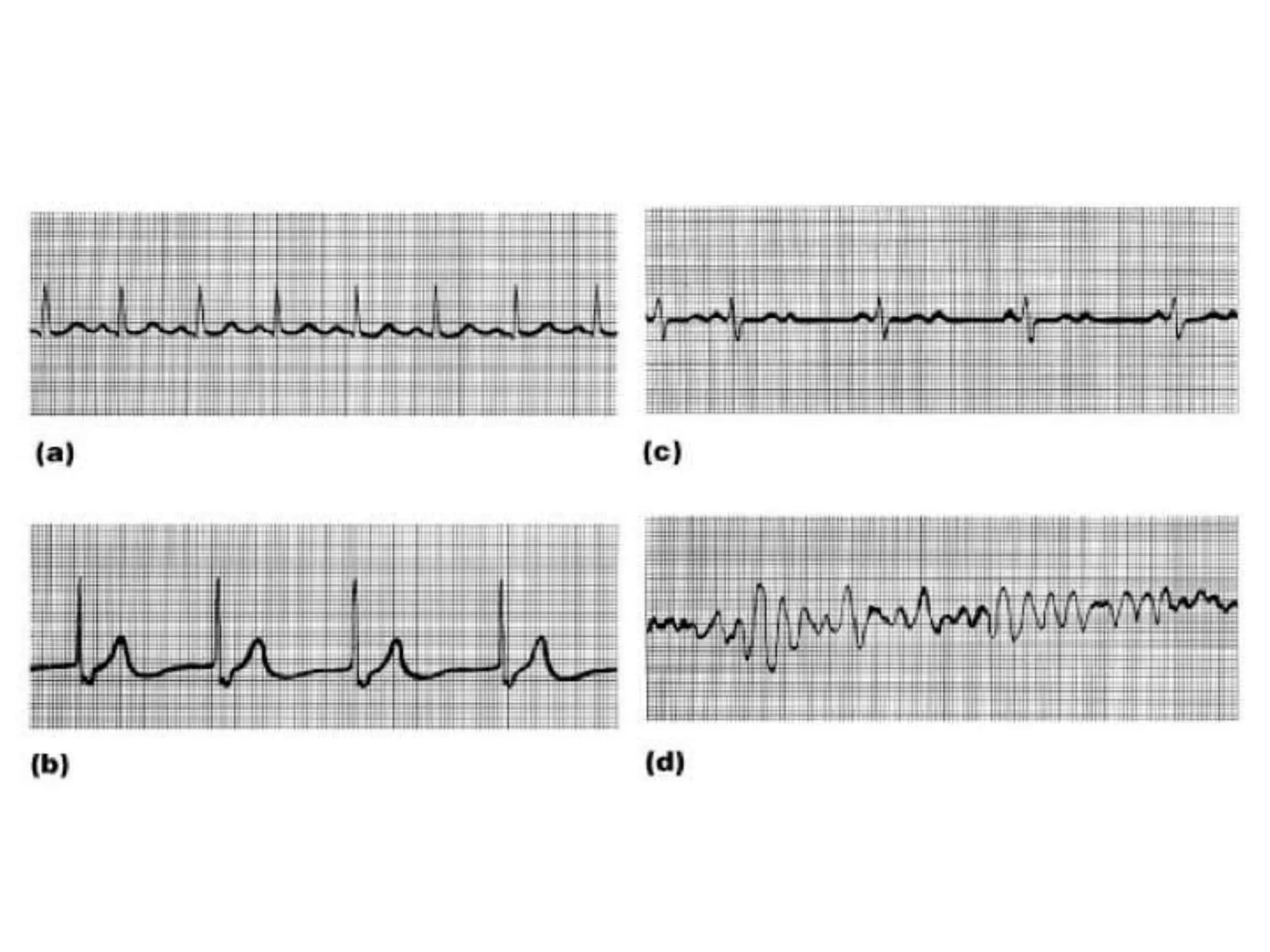 Electrical Activity of the Heart | PPTX