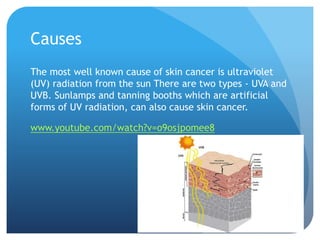 198603726 skin-cancer | PPT