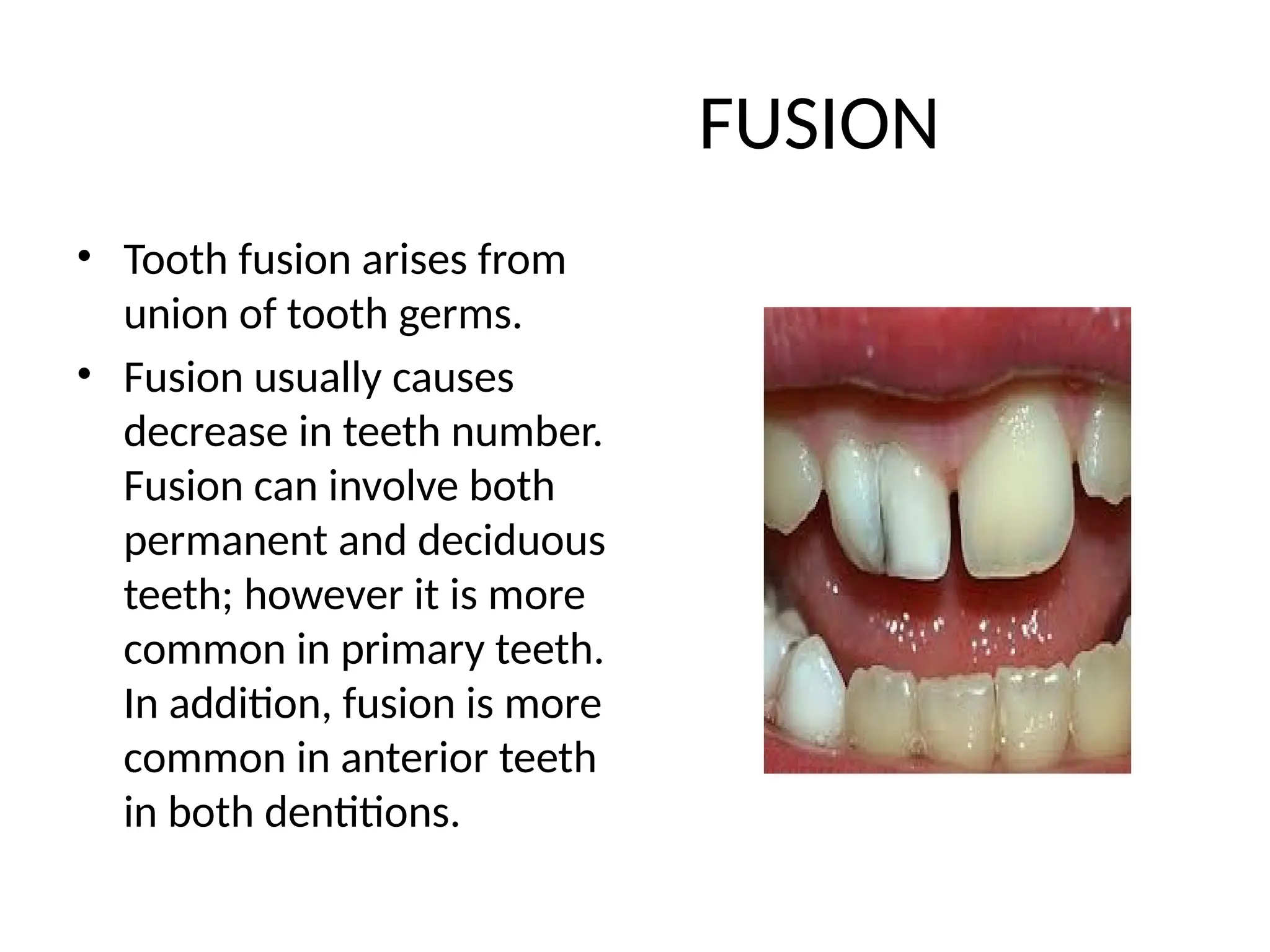 199.CONGENITAL ANOMALIES OF TEETH an INTRO.pptx