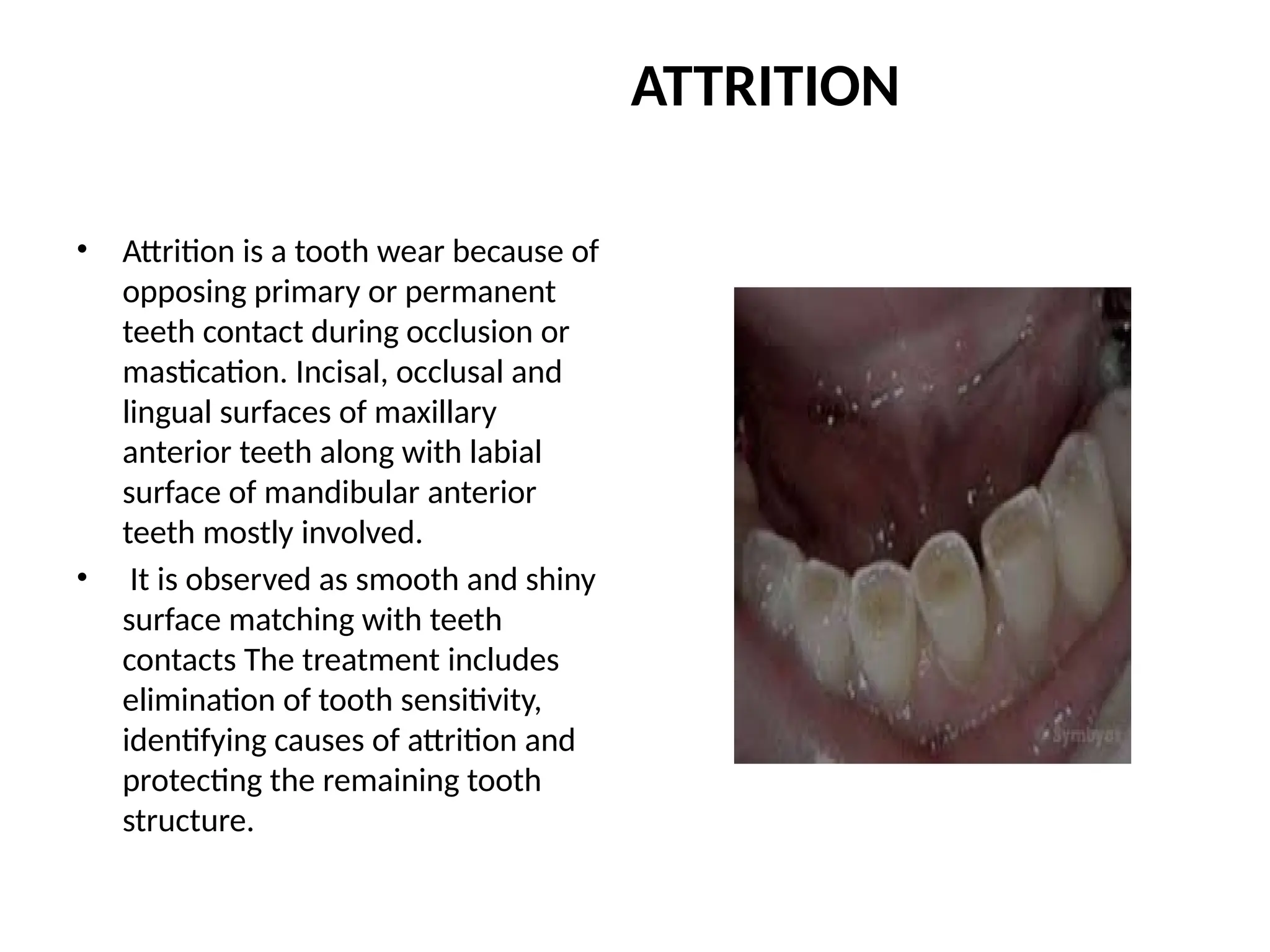 199.CONGENITAL ANOMALIES OF TEETH an INTRO.pptx