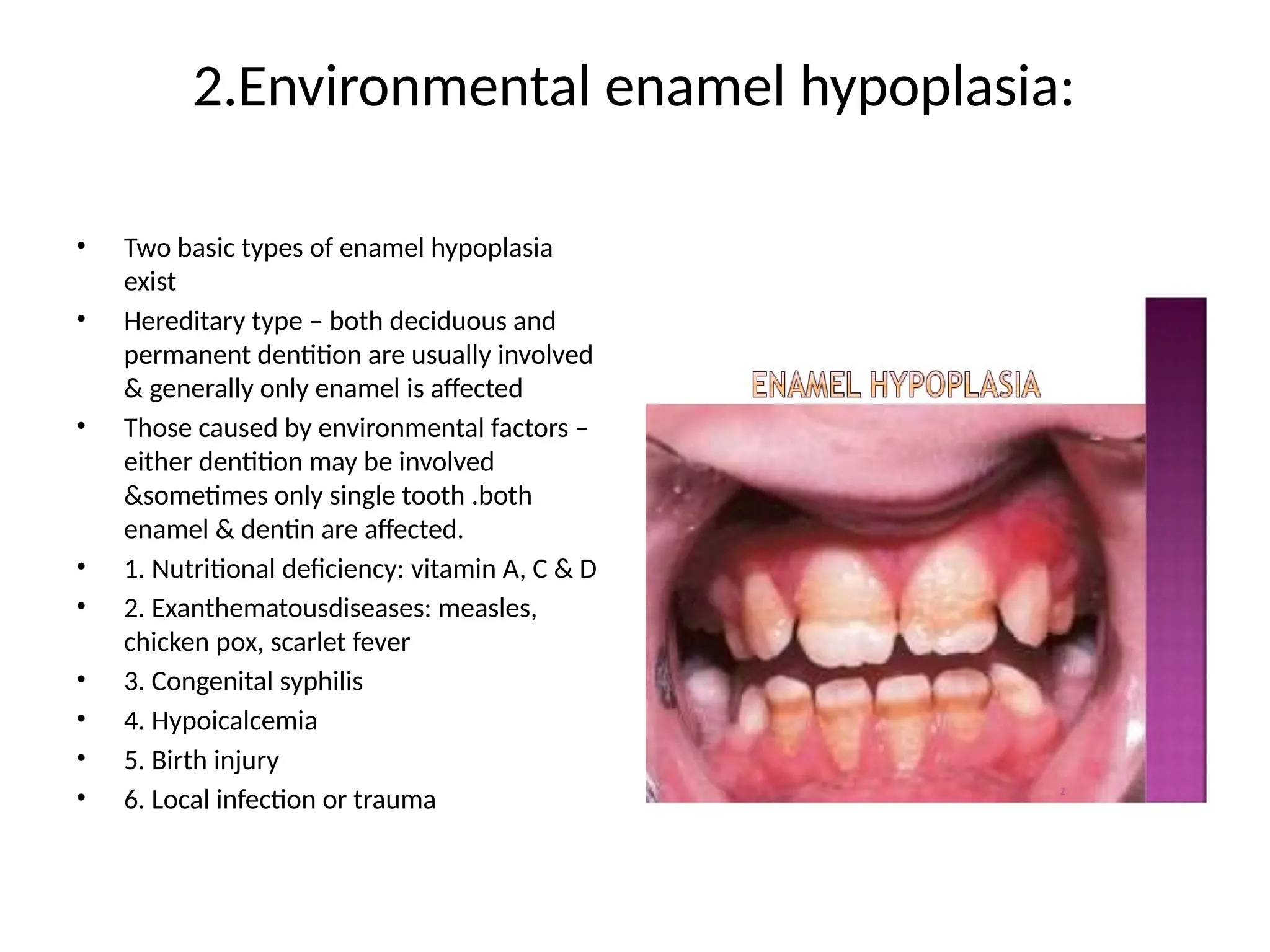 199.CONGENITAL ANOMALIES OF TEETH an INTRO.pptx